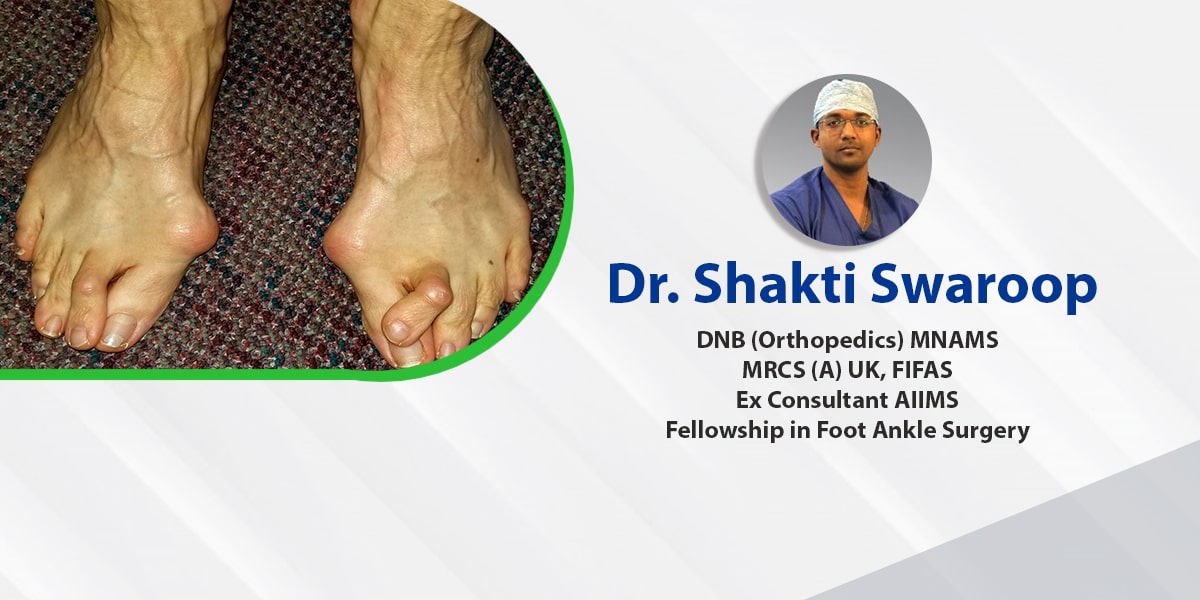 Top 10 best foot and ankle specialist in Bhubaneswar (Updated)