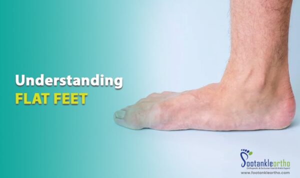Understanding Flat Feet : How a Foot and Ankle Surgeon Can Help Relieve ...