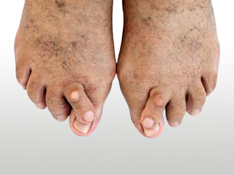 Find a foot and ankle clinic in Bhubaneswar - Footankleortho